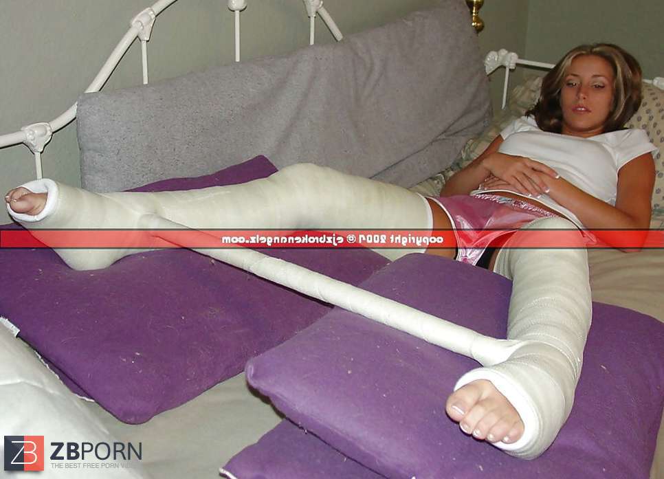 Gips Cast Zb Porn