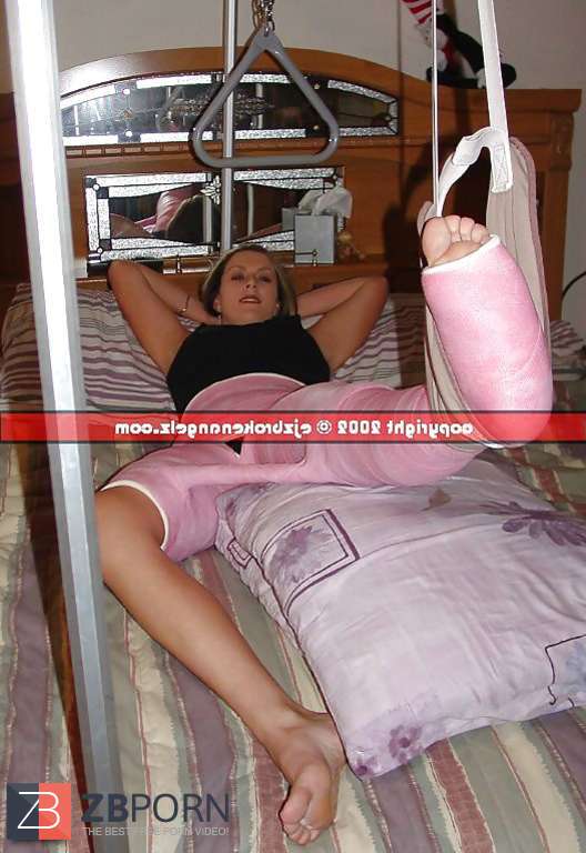 Gips Cast Zb Porn